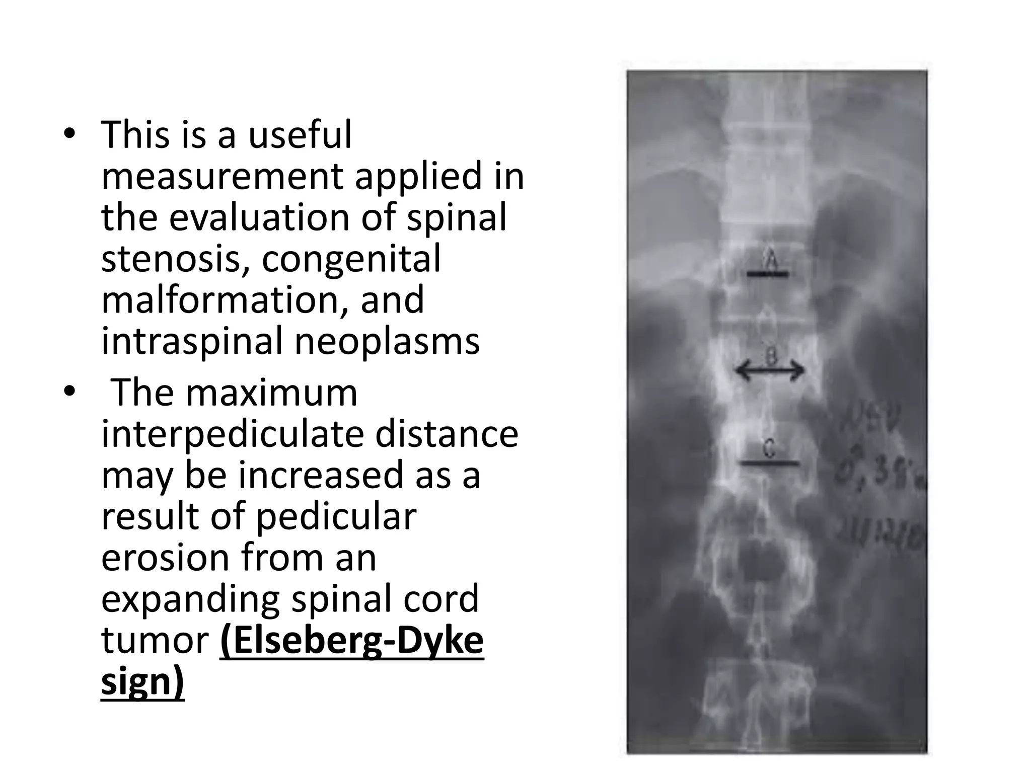 Radiographic lines and angles | PPTX