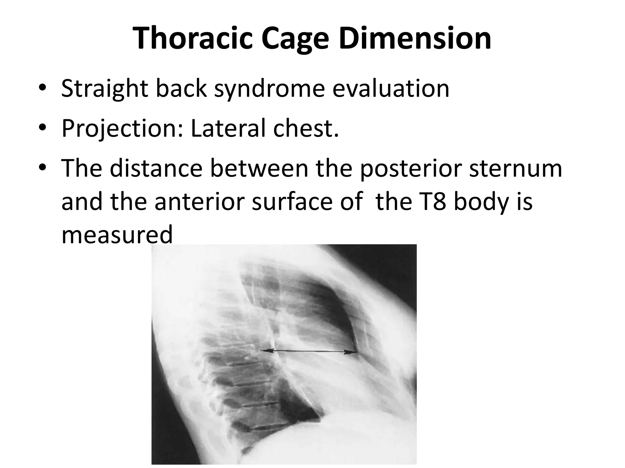 Radiographic lines and angles | PPTX