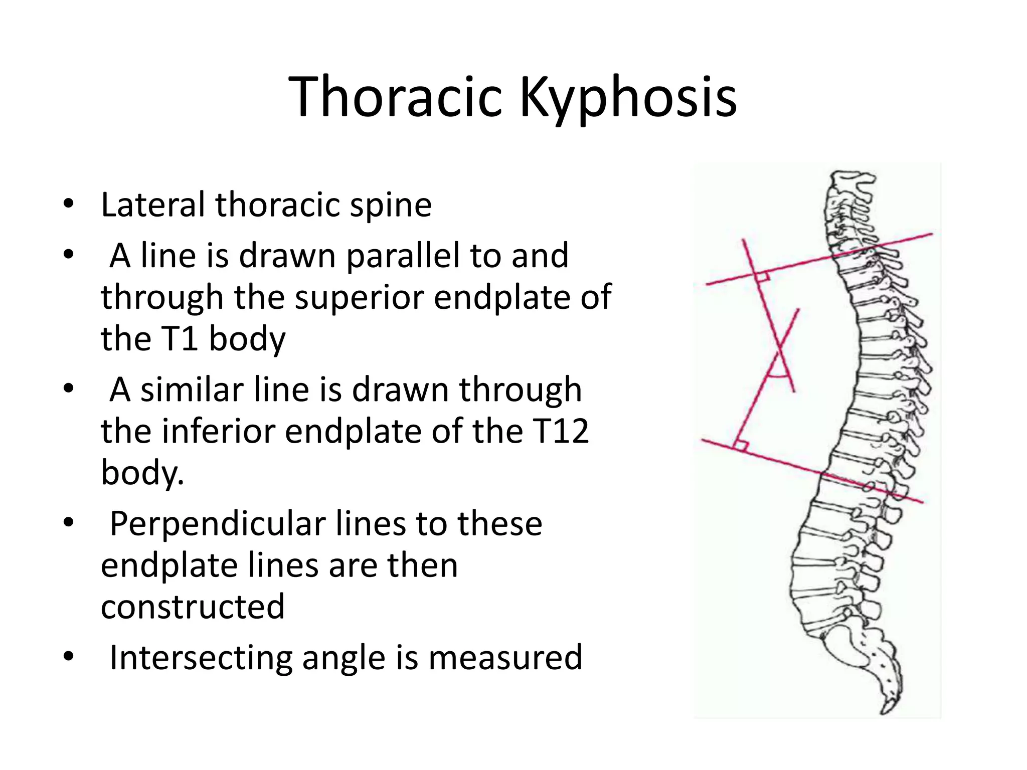 Radiographic lines and angles | PPTX