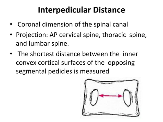 Radiographic lines and angles | PPTX
