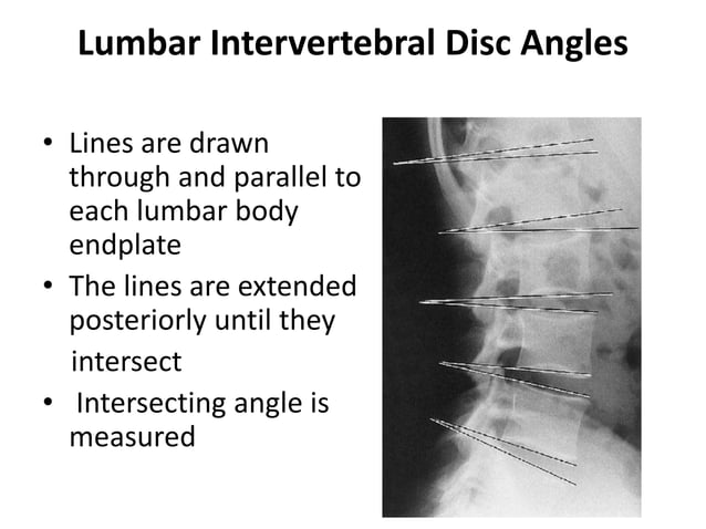 Radiographic lines and angles | PPTX