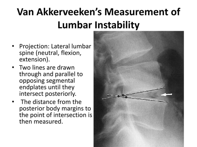 Radiographic lines and angles | PPTX