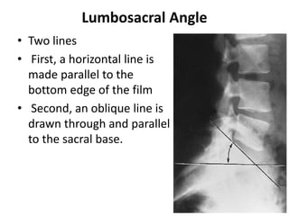 Radiographic lines and angles | PPTX