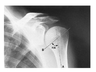 Radiographic lines and angles | PPTX