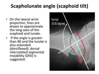 Radiographic lines and angles | PPTX