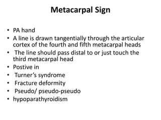 Radiographic lines and angles | PPTX