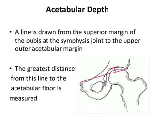 Radiographic lines and angles | PPTX