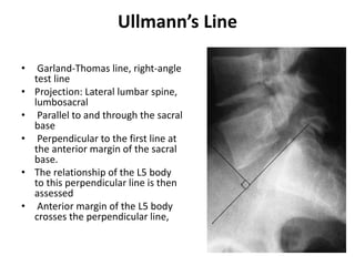 Radiographic lines and angles | PPT