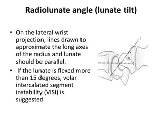Radiographic lines and angles | PPT