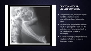 RADIOGRAPHIC MANIFESTATIONS OF SYSTEMIC DISORDERS IN JAWS.pptx