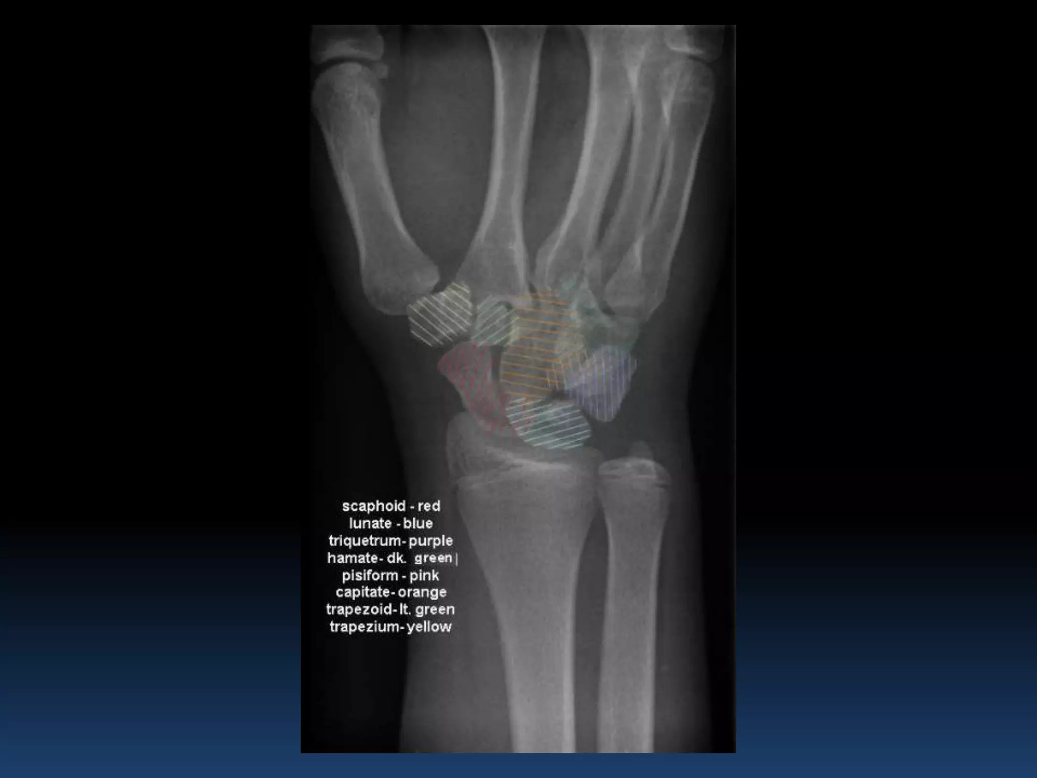 Radiographic MSK Anatomy | PPTX