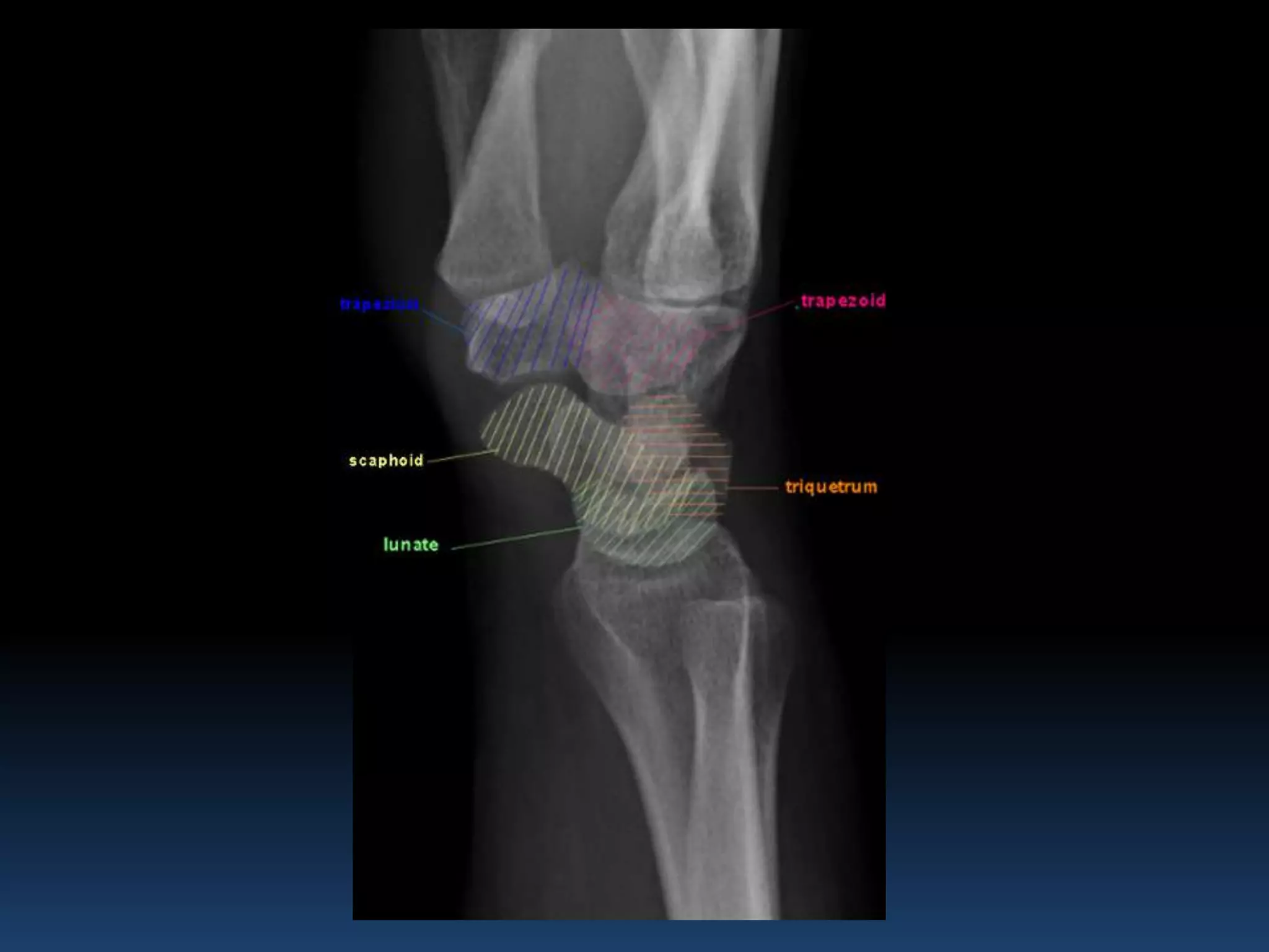 Radiographic MSK Anatomy | PPTX