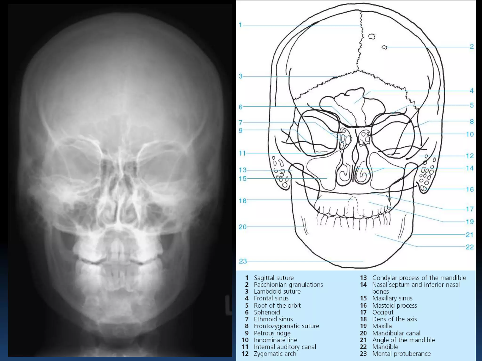 Radiographic MSK Anatomy | PPTX