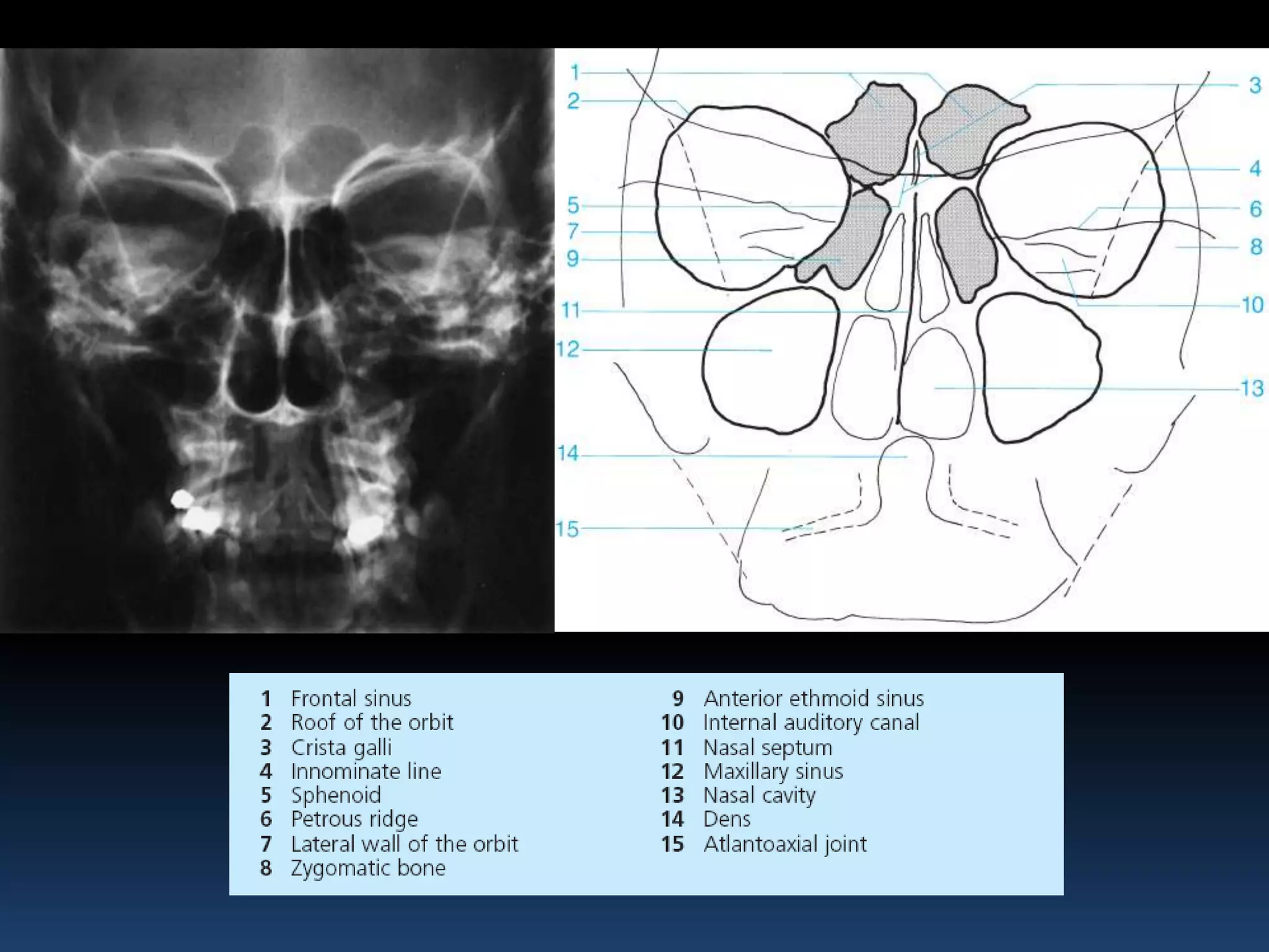 Radiographic MSK Anatomy | PPTX