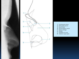 Radiographic MSK Anatomy | PPTX