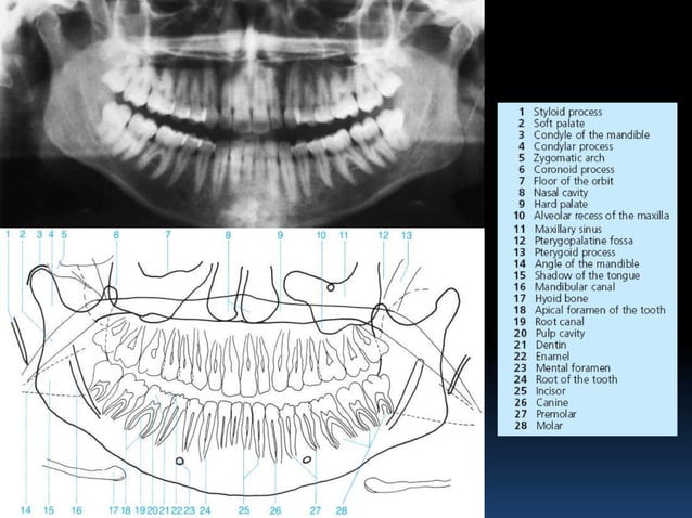 Radiographic MSK Anatomy | PPTX | Death, Injury, or Military Conflict ...