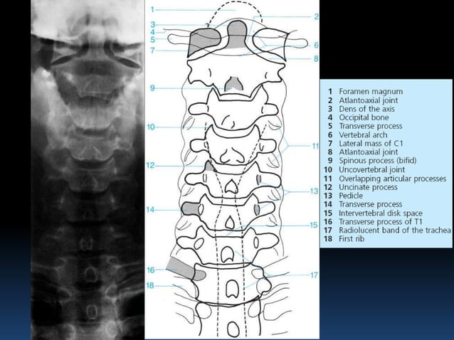 Radiographic MSK Anatomy | PPTX | Death, Injury, or Military Conflict ...