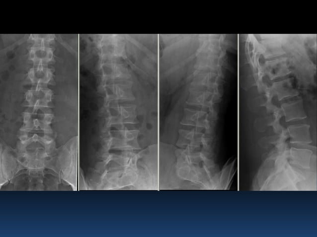 Radiographic MSK Anatomy | PPTX | Death, Injury, or Military Conflict ...