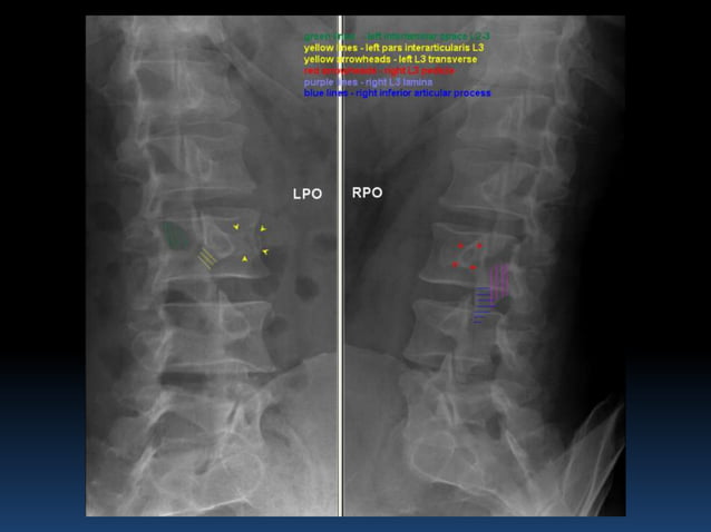 Radiographic MSK Anatomy | PPTX | Death, Injury, or Military Conflict ...