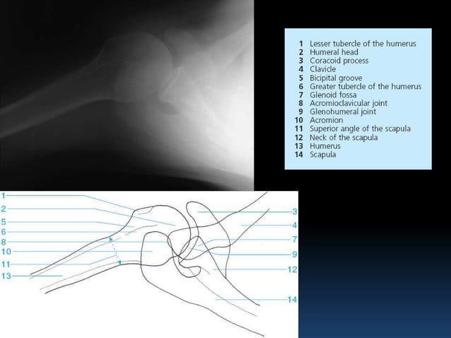 Radiographic MSK Anatomy | PPTX | Death, Injury, or Military Conflict ...