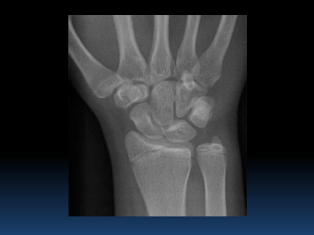 Radiographic MSK Anatomy | PPTX | Death, Injury, or Military Conflict ...