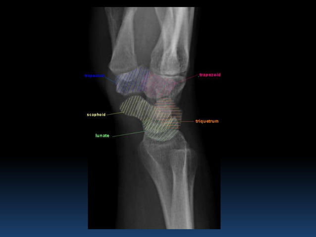 Radiographic MSK Anatomy | PPTX | Death, Injury, or Military Conflict ...
