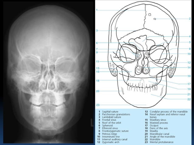 Radiographic MSK Anatomy | PPTX | Death, Injury, or Military Conflict ...