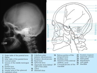 Radiographic MSK Anatomy | PPTX
