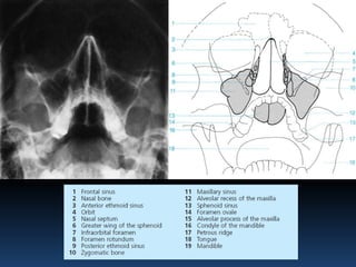 Radiographic MSK Anatomy | PPTX