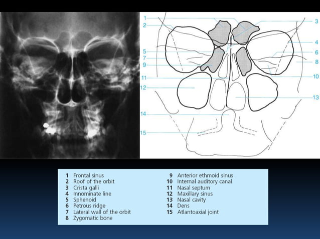 Radiographic MSK Anatomy | PPTX | Death, Injury, or Military Conflict ...
