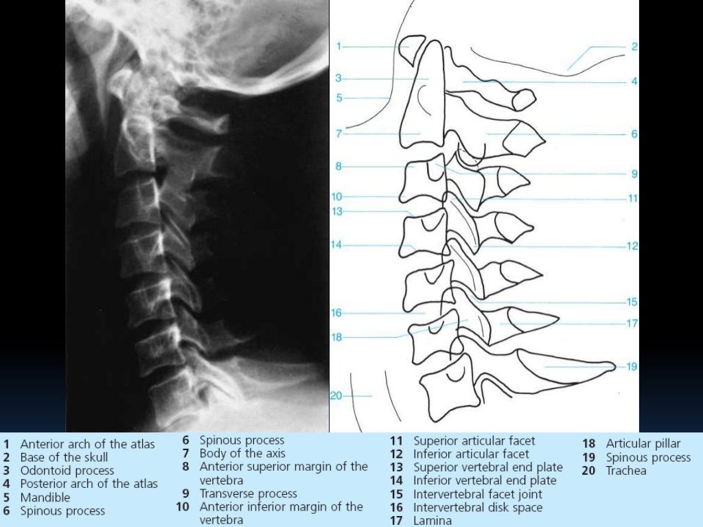 Radiographic MSK Anatomy