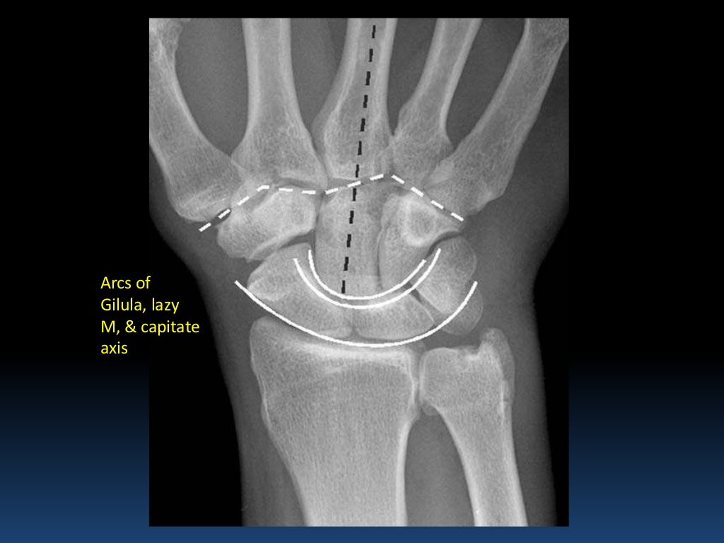 Radiographic MSK Anatomy