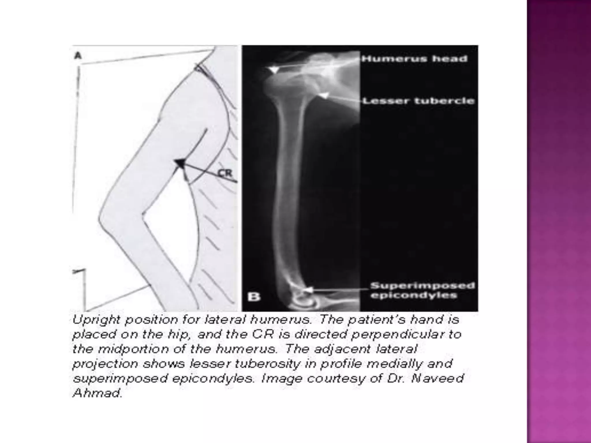 Radiographic positioning of humerus and shoulder | PPTX