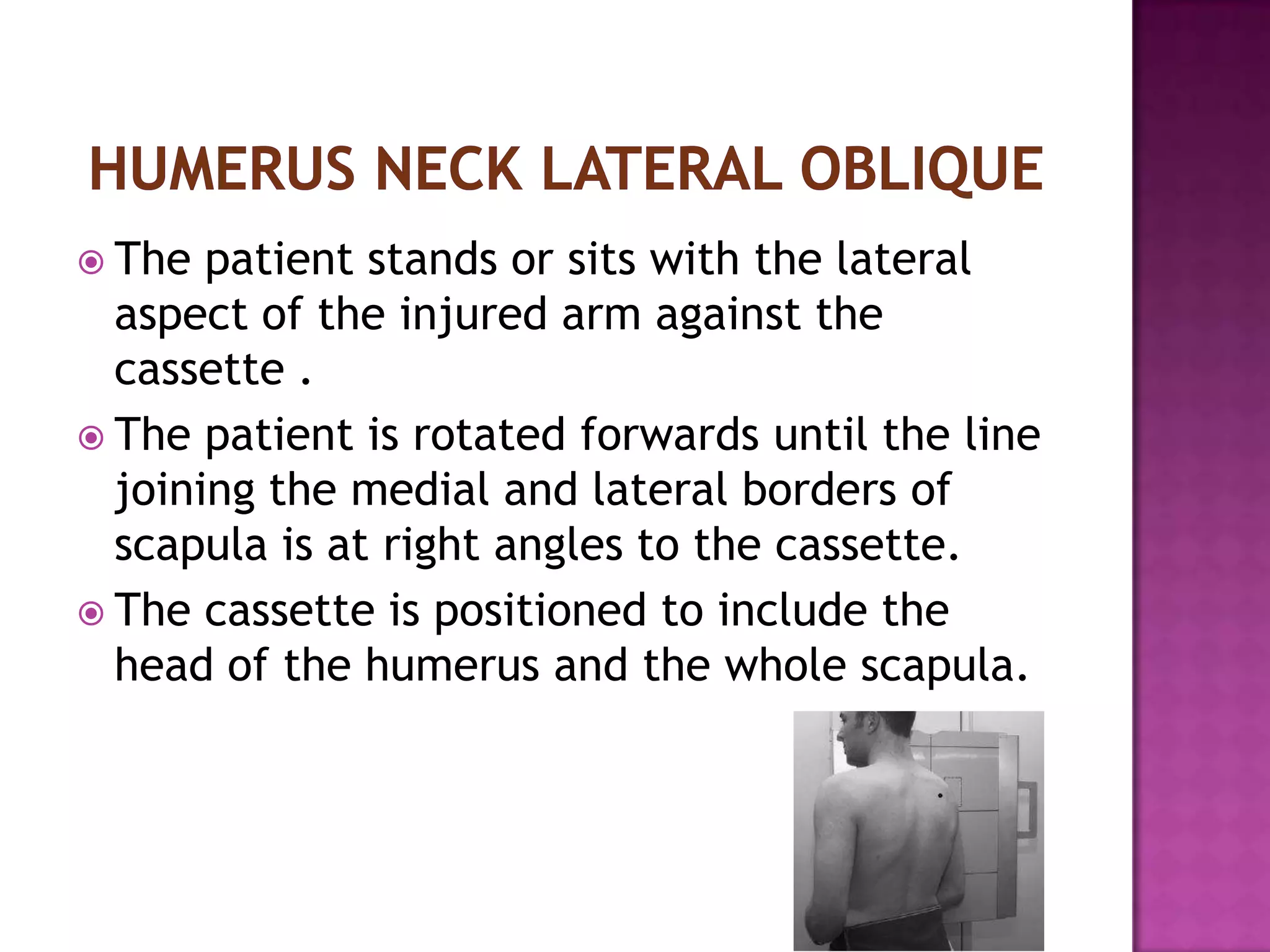 Radiographic positioning of humerus and shoulder | PPTX