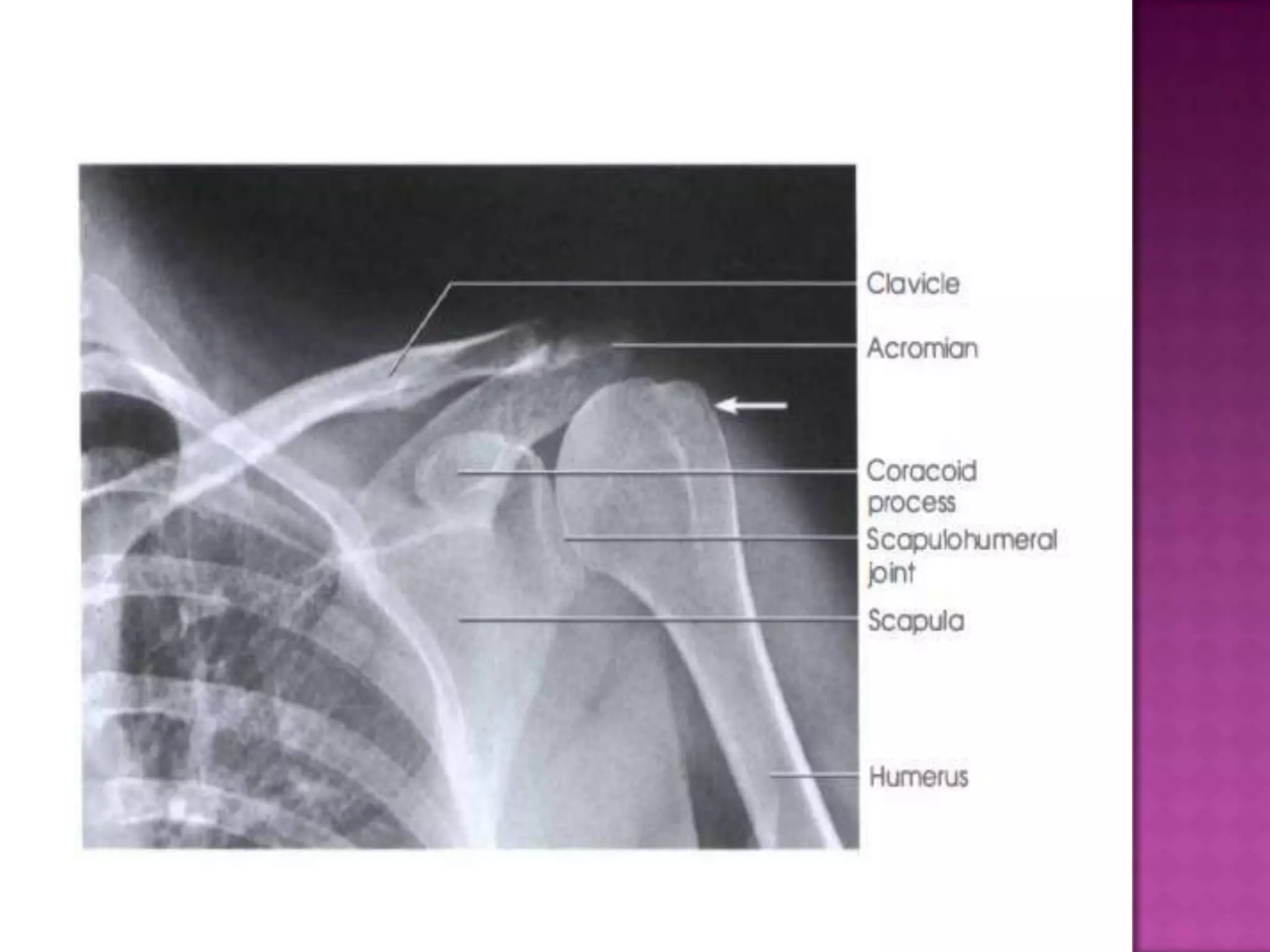 Radiographic positioning of humerus and shoulder | PPTX