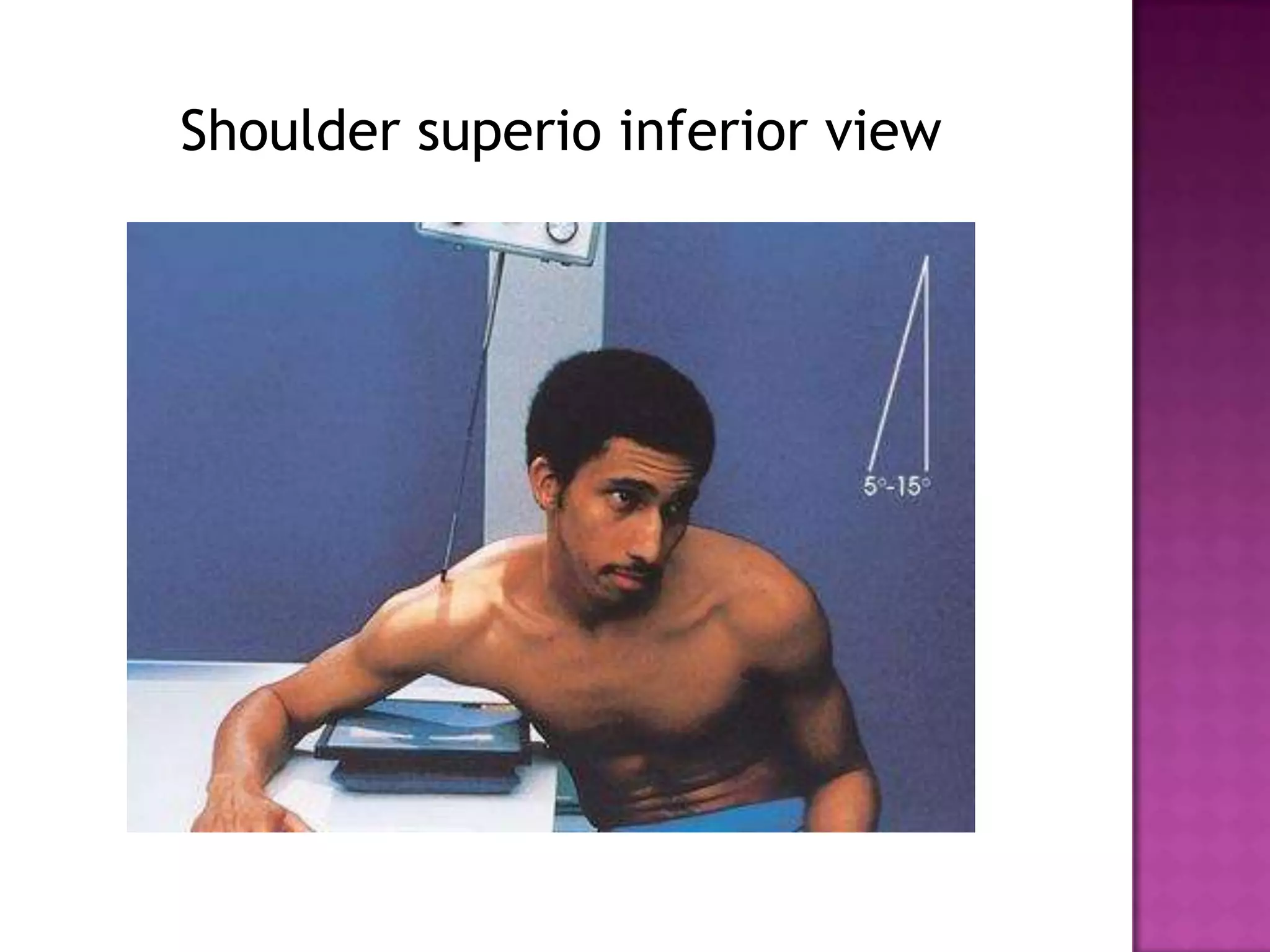 Radiographic positioning of humerus and shoulder | PPTX