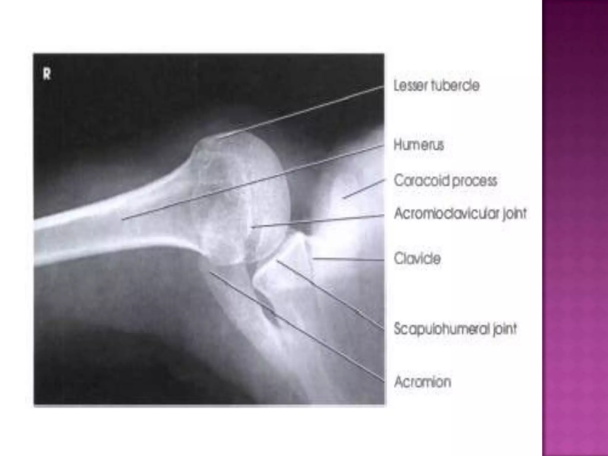 Radiographic positioning of humerus and shoulder | PPTX