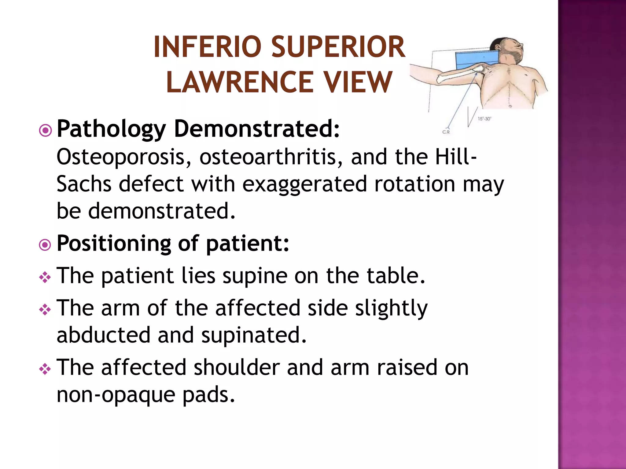 Radiographic positioning of humerus and shoulder | PPTX