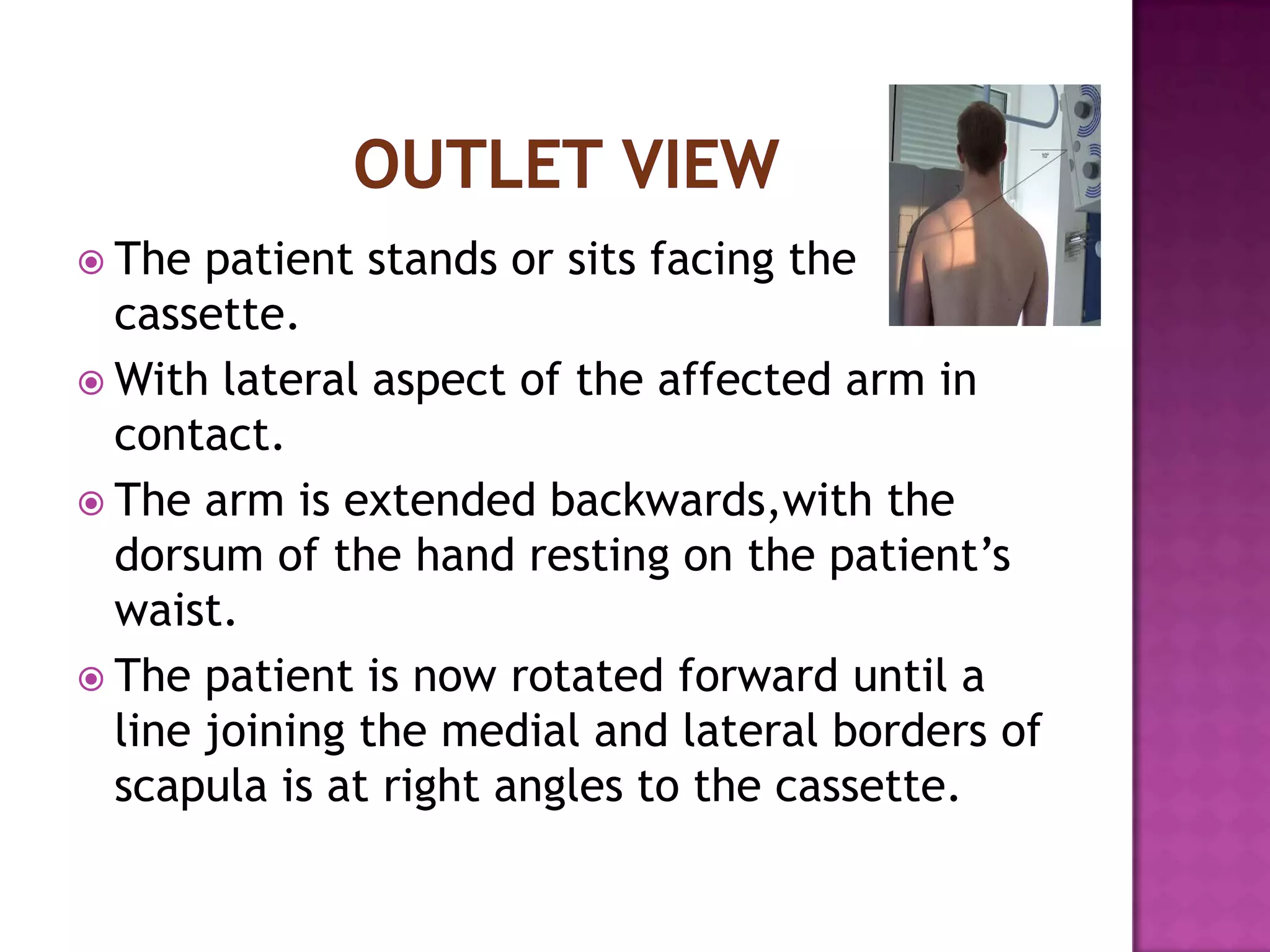 Radiographic positioning of humerus and shoulder | PPTX