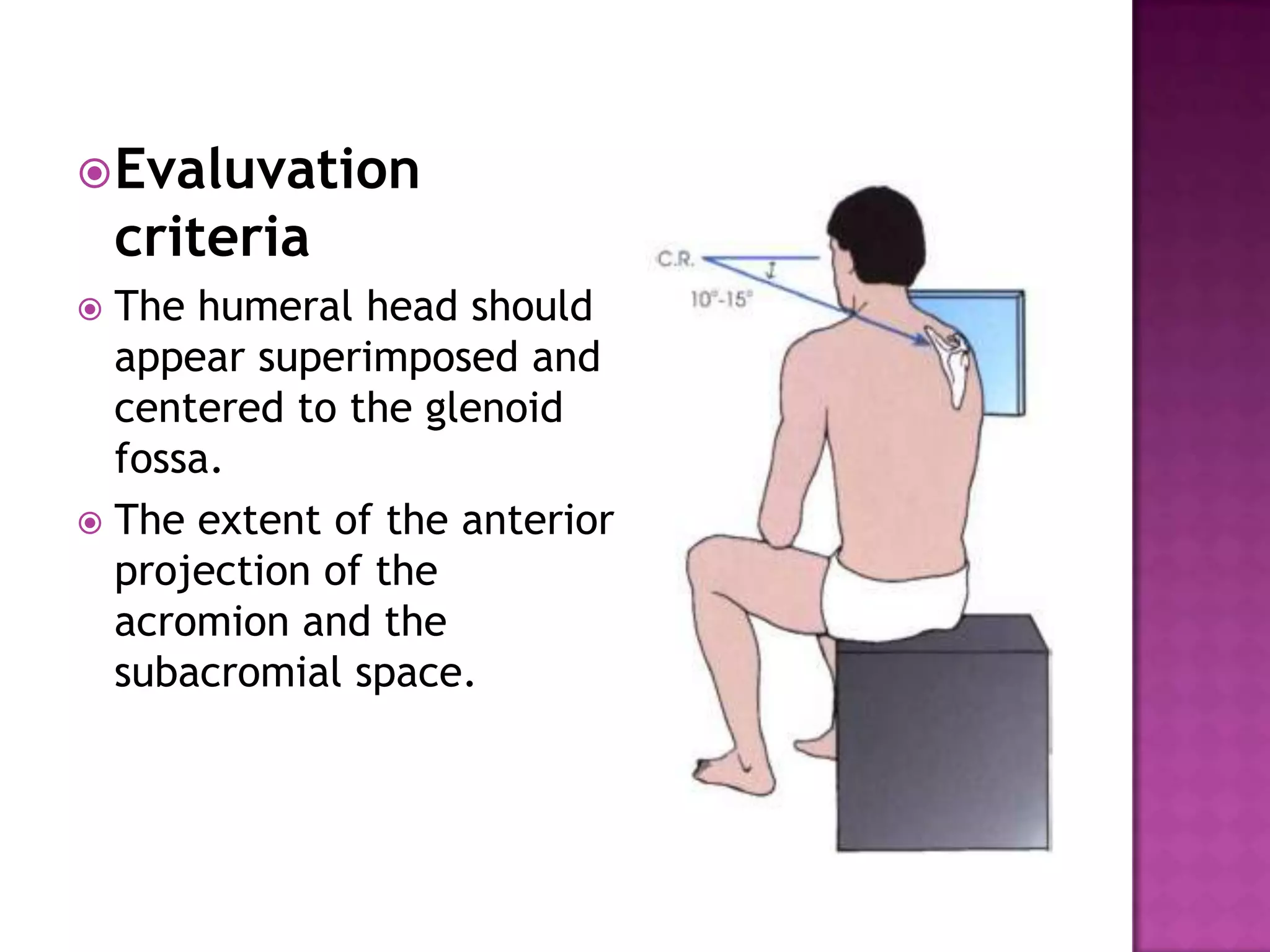 Radiographic positioning of humerus and shoulder | PPTX