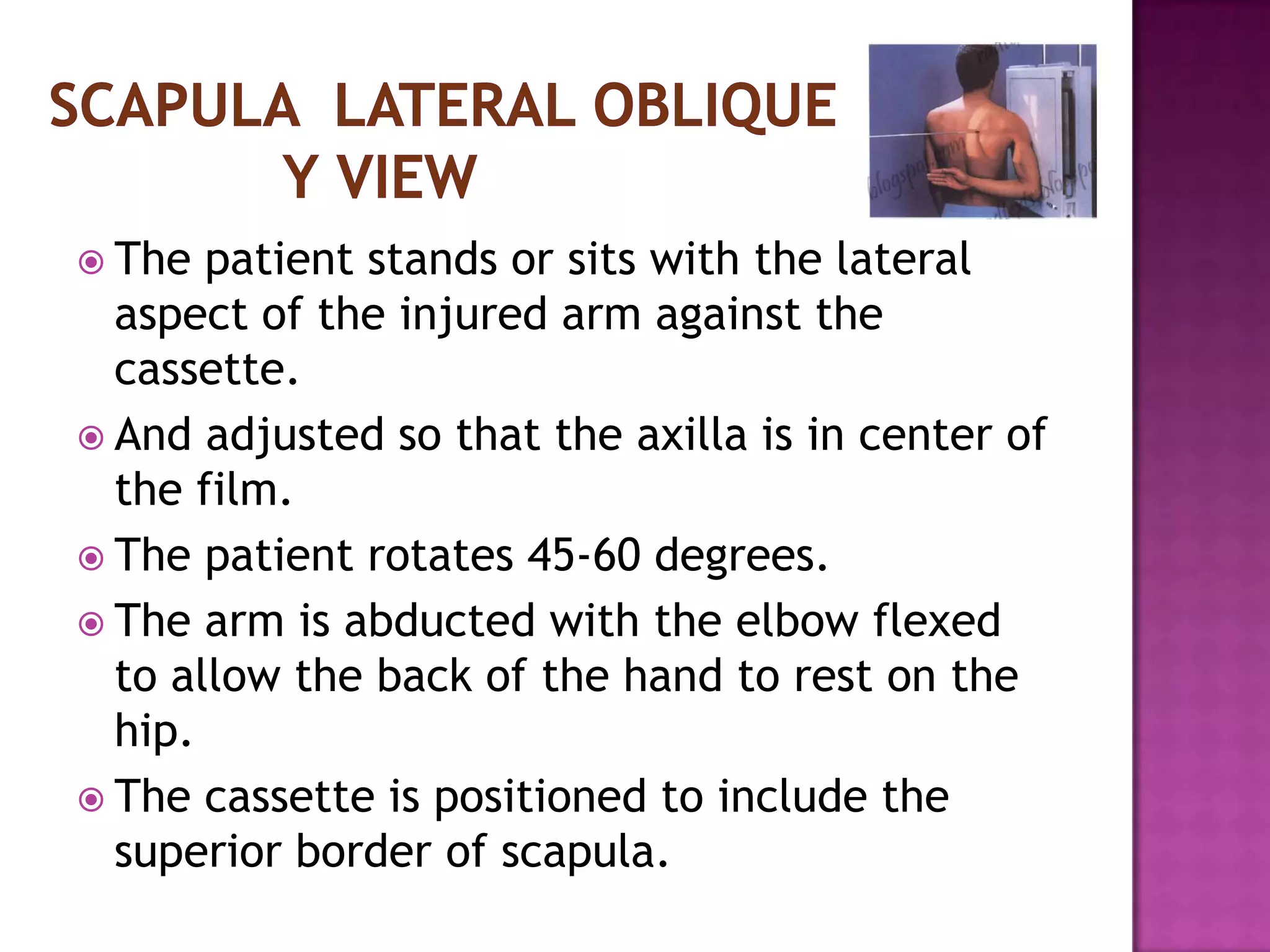 Radiographic positioning of humerus and shoulder | PPTX
