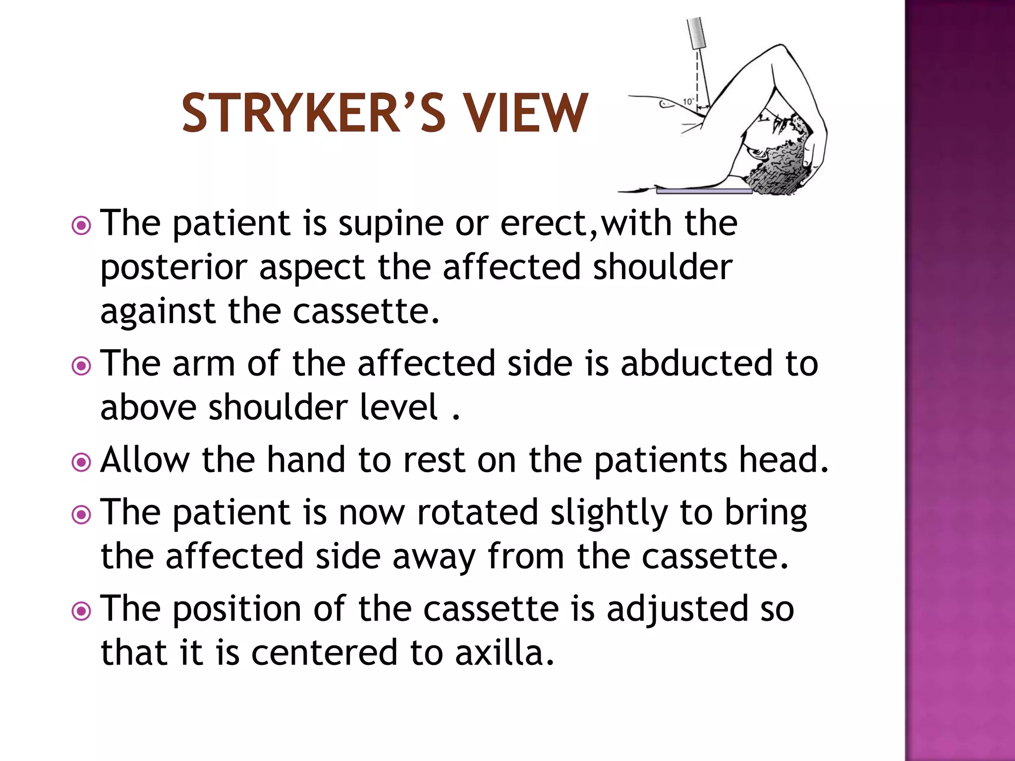 Radiographic positioning of humerus and shoulder | PPTX