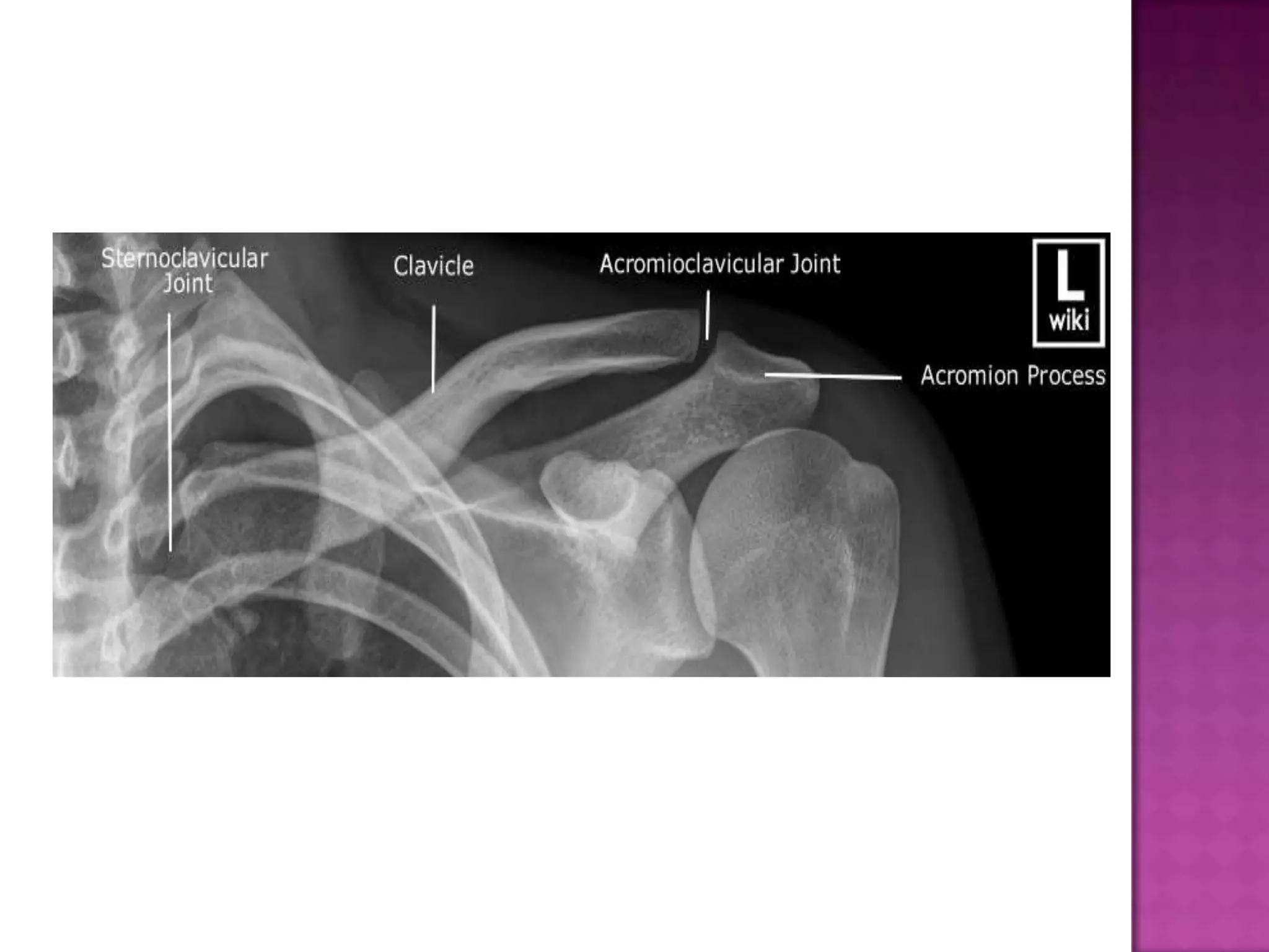 Radiographic positioning of humerus and shoulder | PPTX