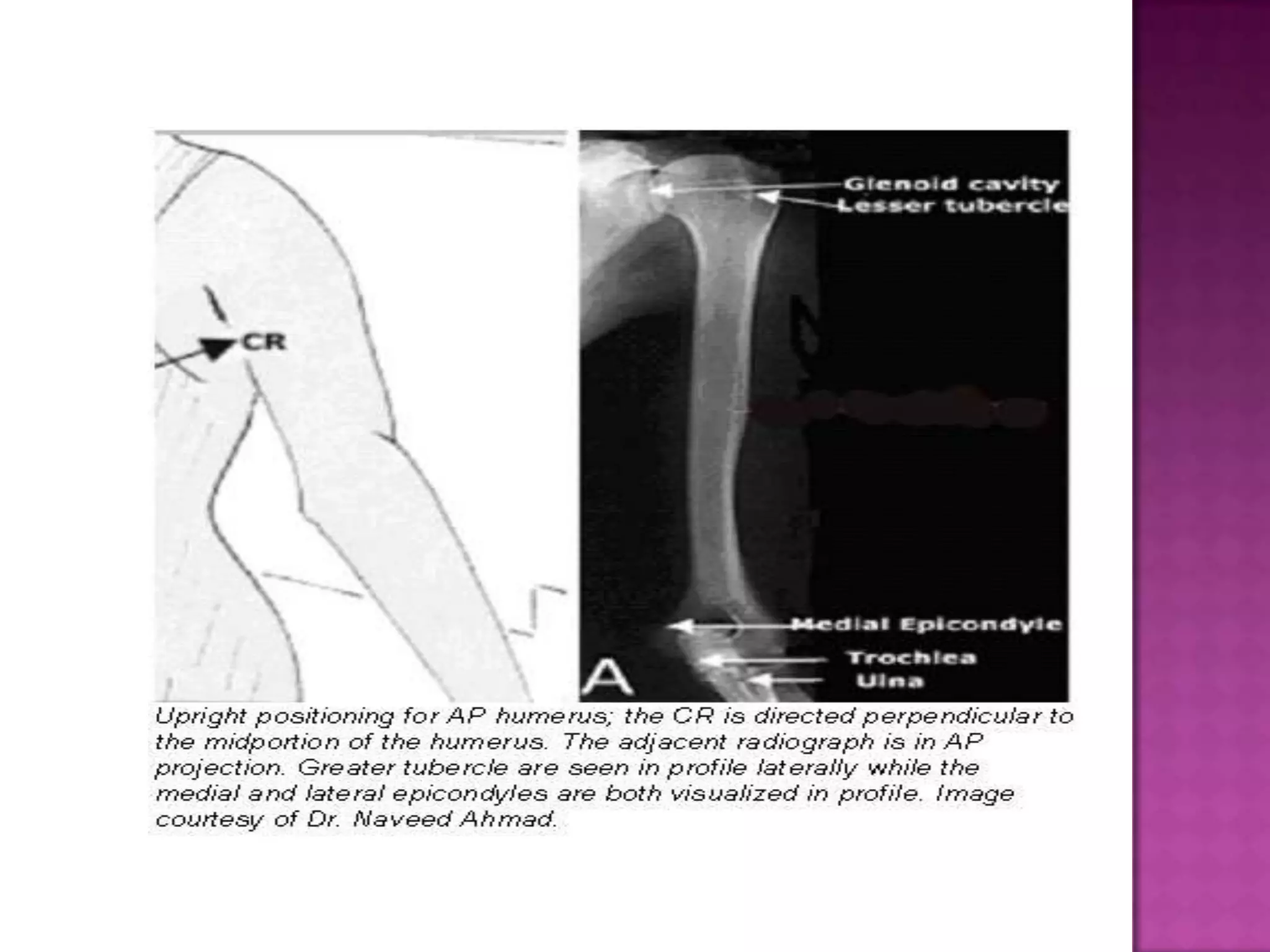 Radiographic positioning of humerus and shoulder | PPTX