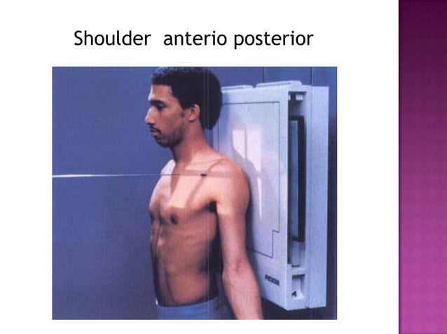 Radiographic positioning of humerus and shoulder | PPTX | Death, Injury ...
