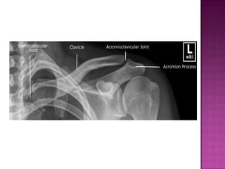 Radiographic positioning of humerus and shoulder | PPTX