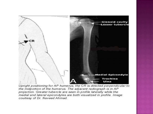 Radiographic positioning of humerus and shoulder | PPTX | Death, Injury ...