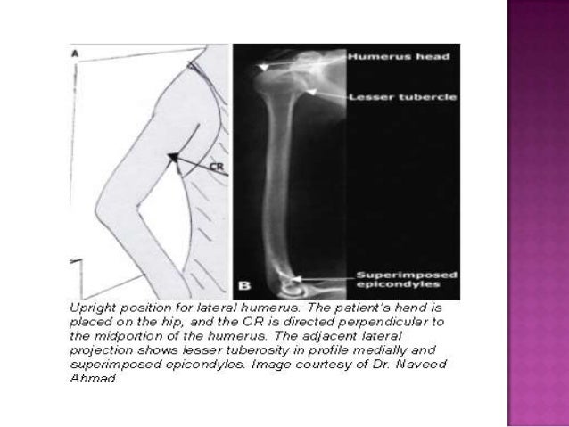 Radiographic positioning of humerus and shoulder