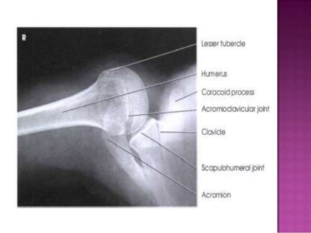Radiographic positioning of humerus and shoulder