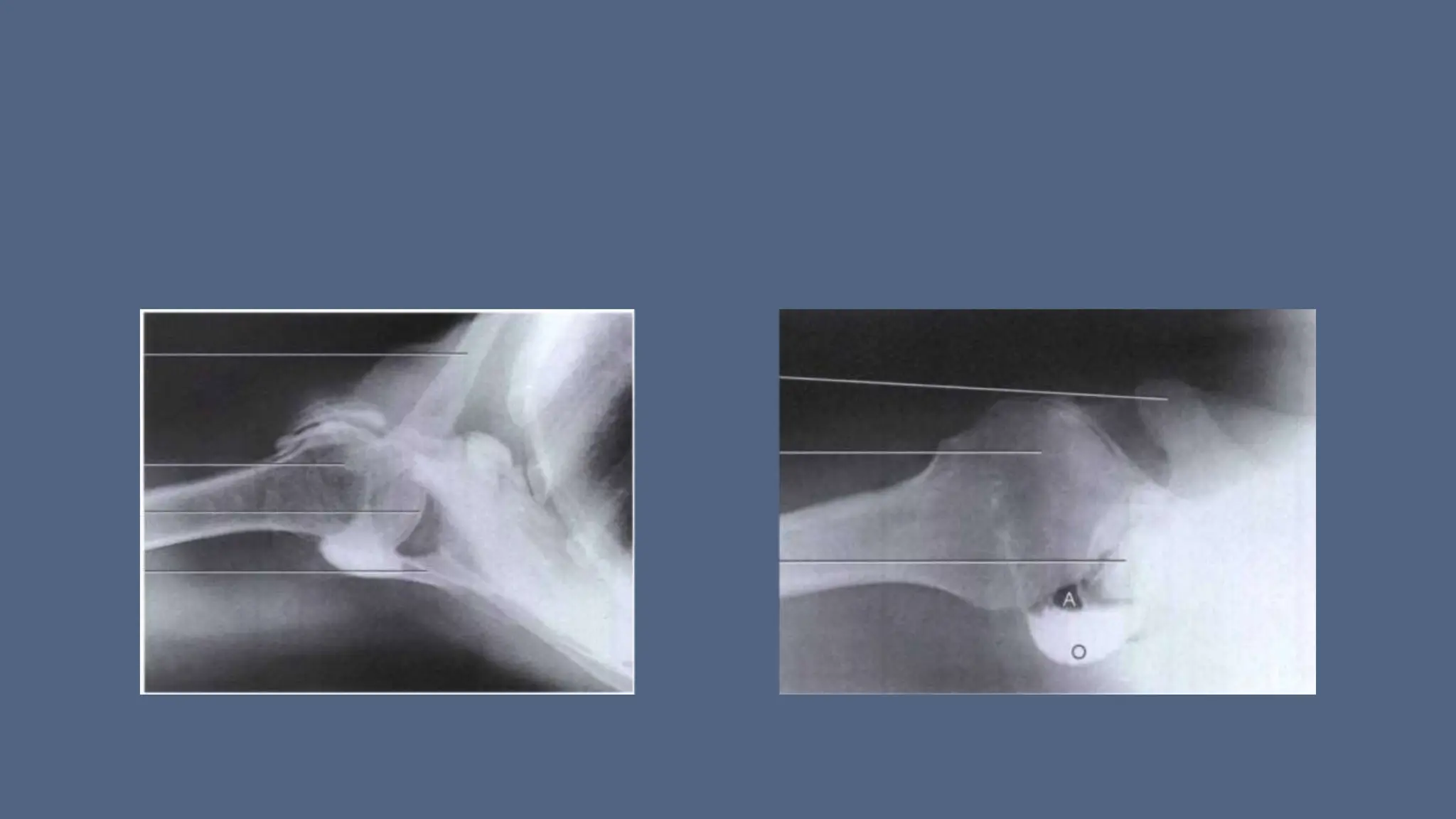 Radiographic procedure arthogram.....pptx